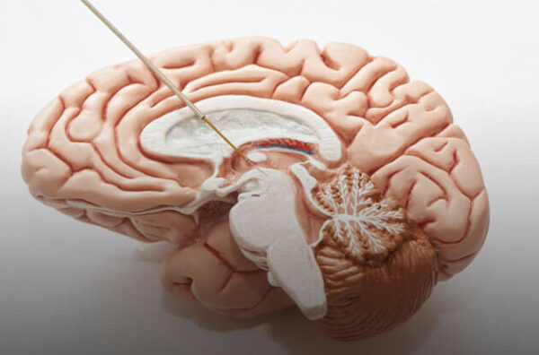 Pathophysiology of Traumatic Brain Injury (TBI) | Causes & Effects